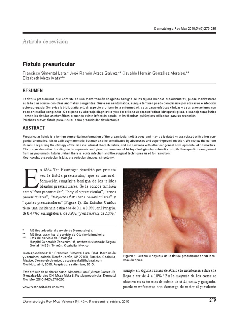Fístula Preauricular: Características y Manejo | PDF | Inflamación | Pecho