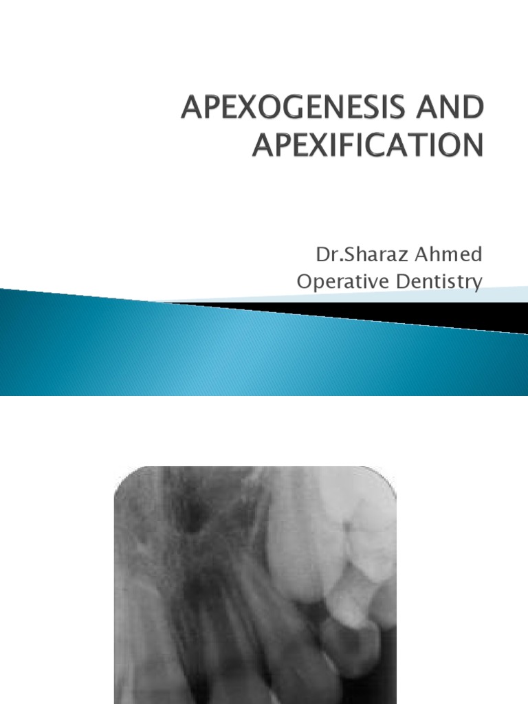 Apexification and Apexogenesis | PDF | Mouth | Health Sciences
