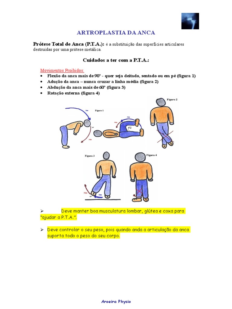Artroplastia Da Anca | PDF | Pé (unidade de medida) | Natureza