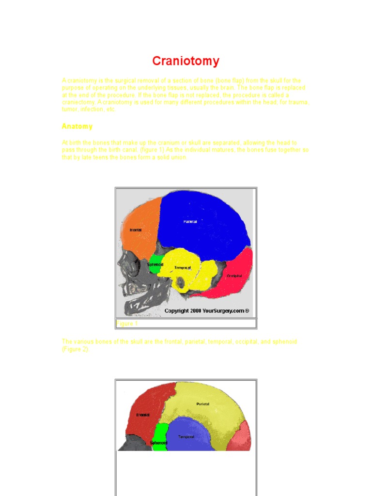 Craniotomy: Anatomy | PDF