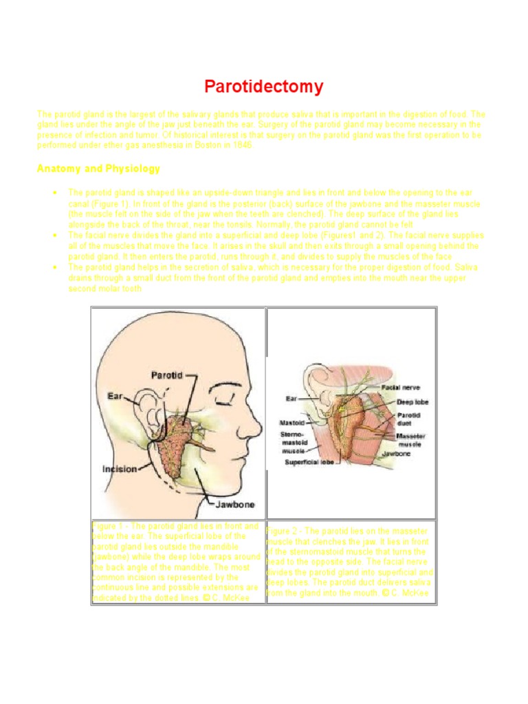Parotidectomy | PDF | Cancer | Neoplasms