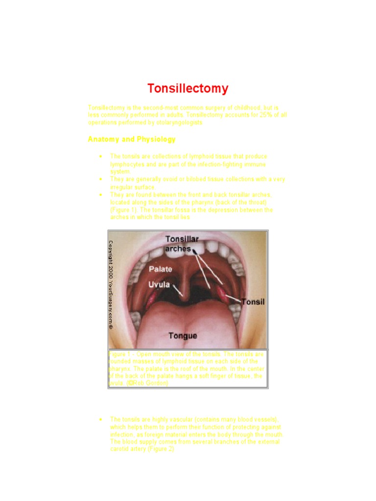 Tonsillectomy: Anatomy and Physiology | Download Free PDF | Medicine | Clinical Medicine