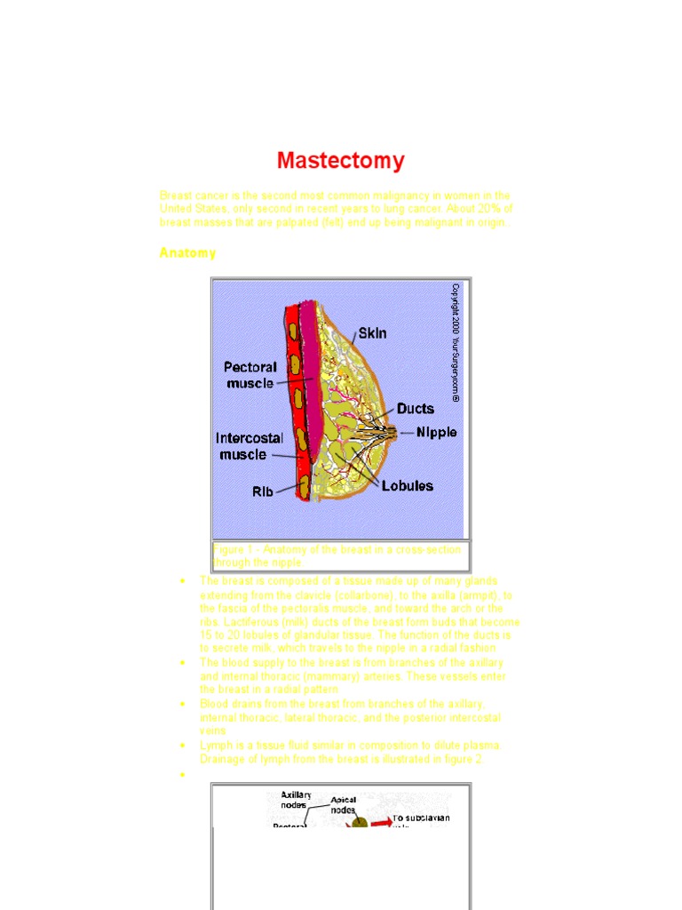 Mastectomy | PDF