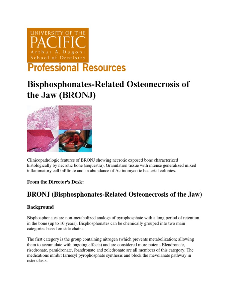 BRONJ (Bisphosphonates-Related Osteonecrosis of The Jaw) | PDF ...