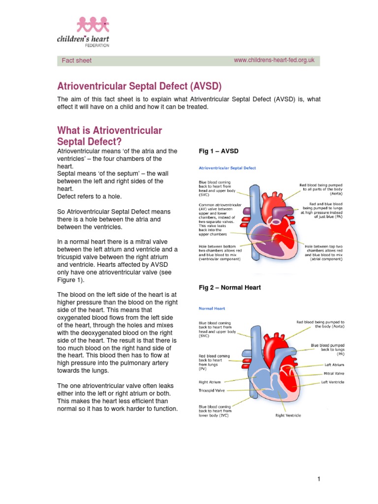 AVSD - Revised Version | Atrium (Heart) | Heart