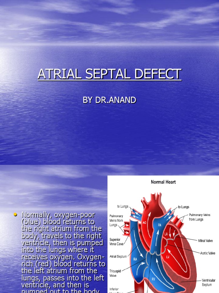Atrial Septal Defect: by DR - Anand | PDF