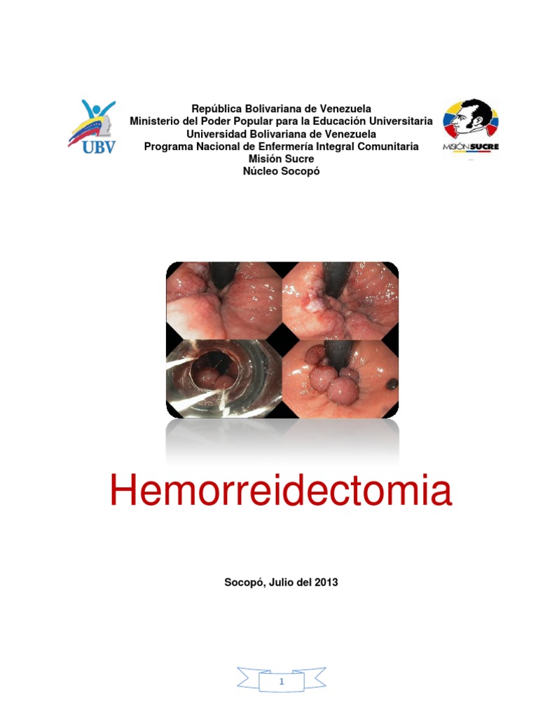 Caso Listo.. Hemoroide | PDF | Hemorroides | Medicina