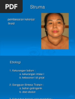 LP Istmolobectomy | PDF