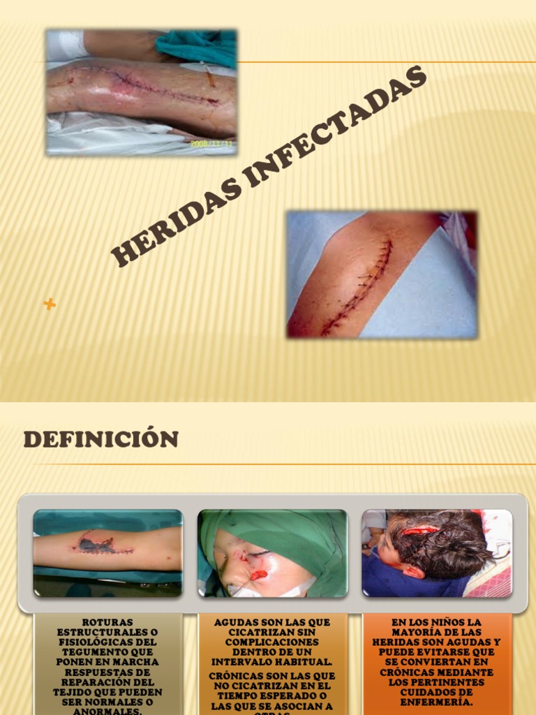 Manejo de Heridas Infectadas | PDF