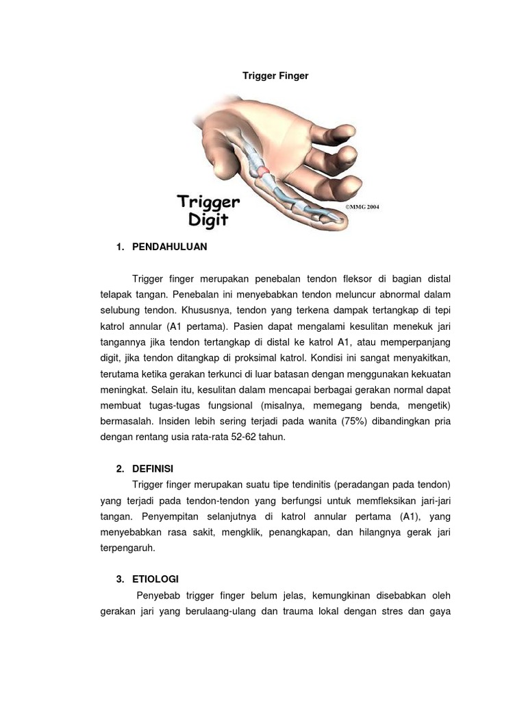 Panduan Trigger Finger | PDF