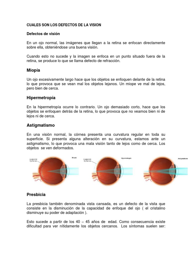 Cuales Son Los Defectos de La Vision | PDF | Amnistía Internacional ...