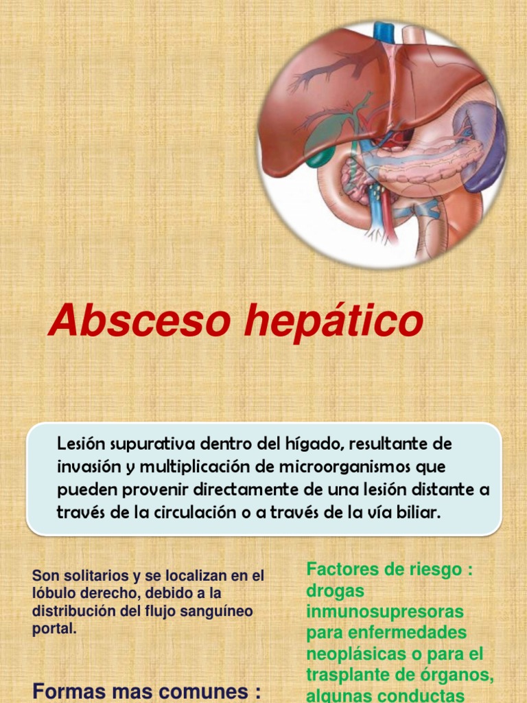 Absceso hepático | Inflamación | Hígado | Prueba gratuita de 30 días ...