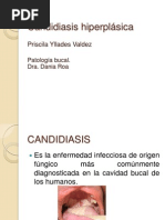 Leucoedema: Lesión Bucal Benigna | PDF | Membrana mucosa | Epitelio