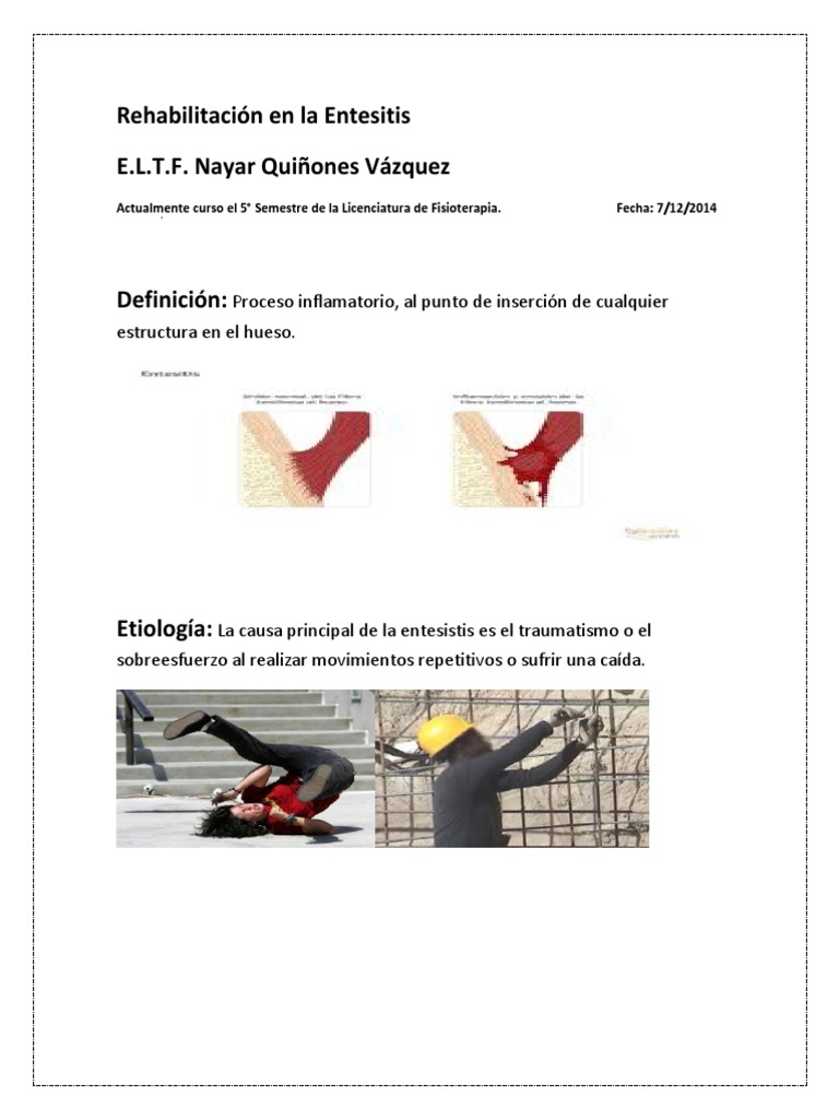 Rehabilitación de la Entesitis | PDF | Dolor | Especialidades Medicas