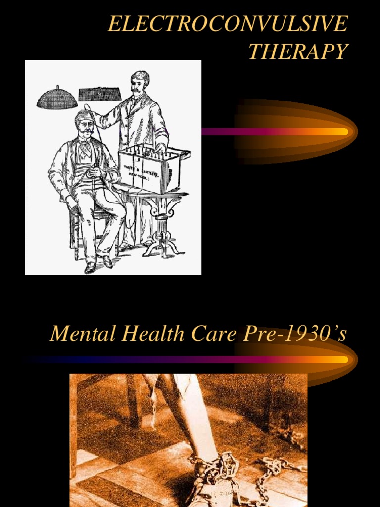 An Overview of Electroconvulsive Therapy: History, Mechanisms ...