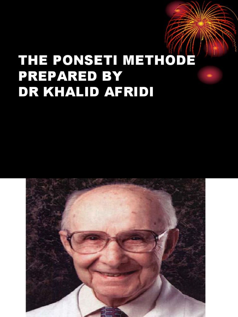 The Ponseti Methode Prepared by DR Khalid Afridi | PDF | Foot ...