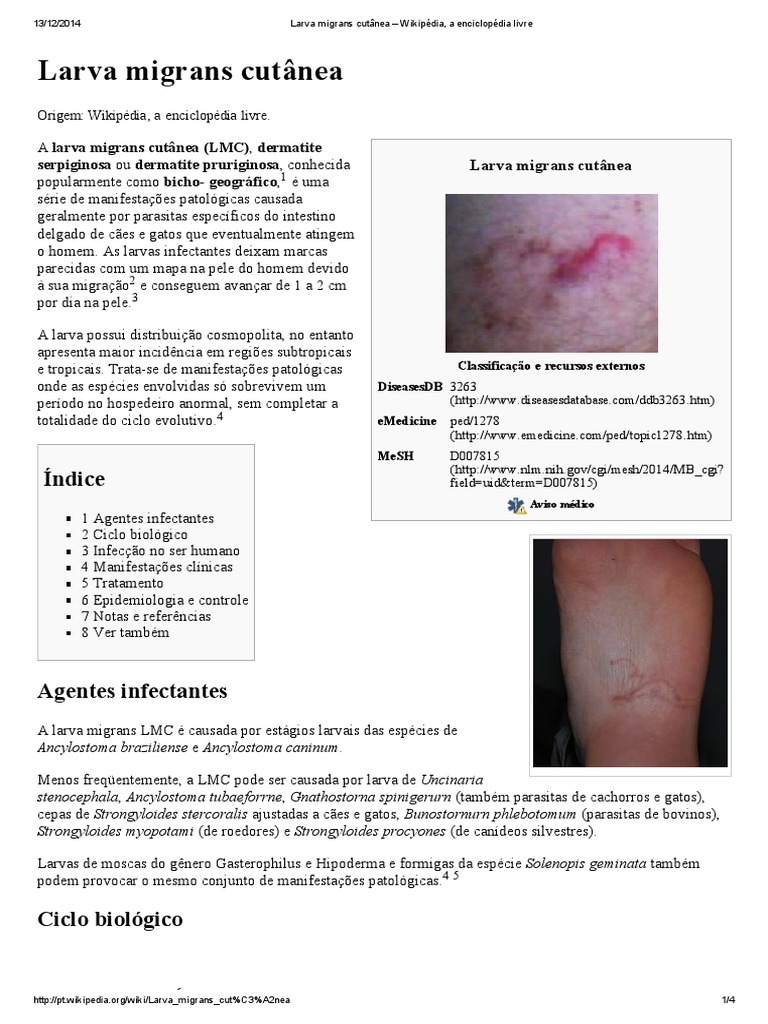 Larva Migrans Cutânea – Wikipédia, A Enciclopédia Livre | Imunologia ...
