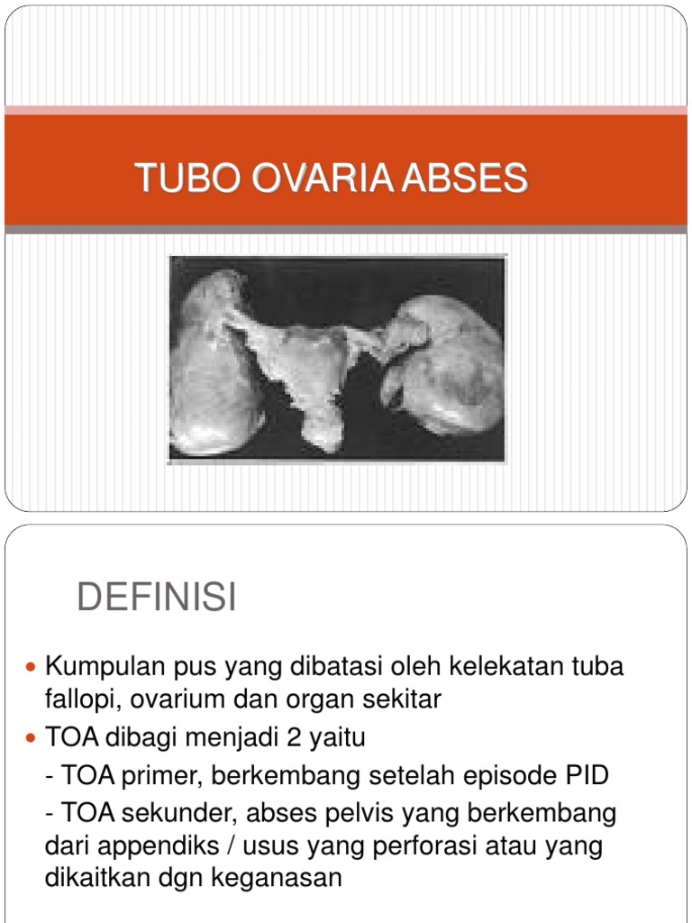 TUBAL OVARIAN ABSCESS: ETIOLOGY, CLINICAL PRESENTATION, DIAGNOSIS AND ...