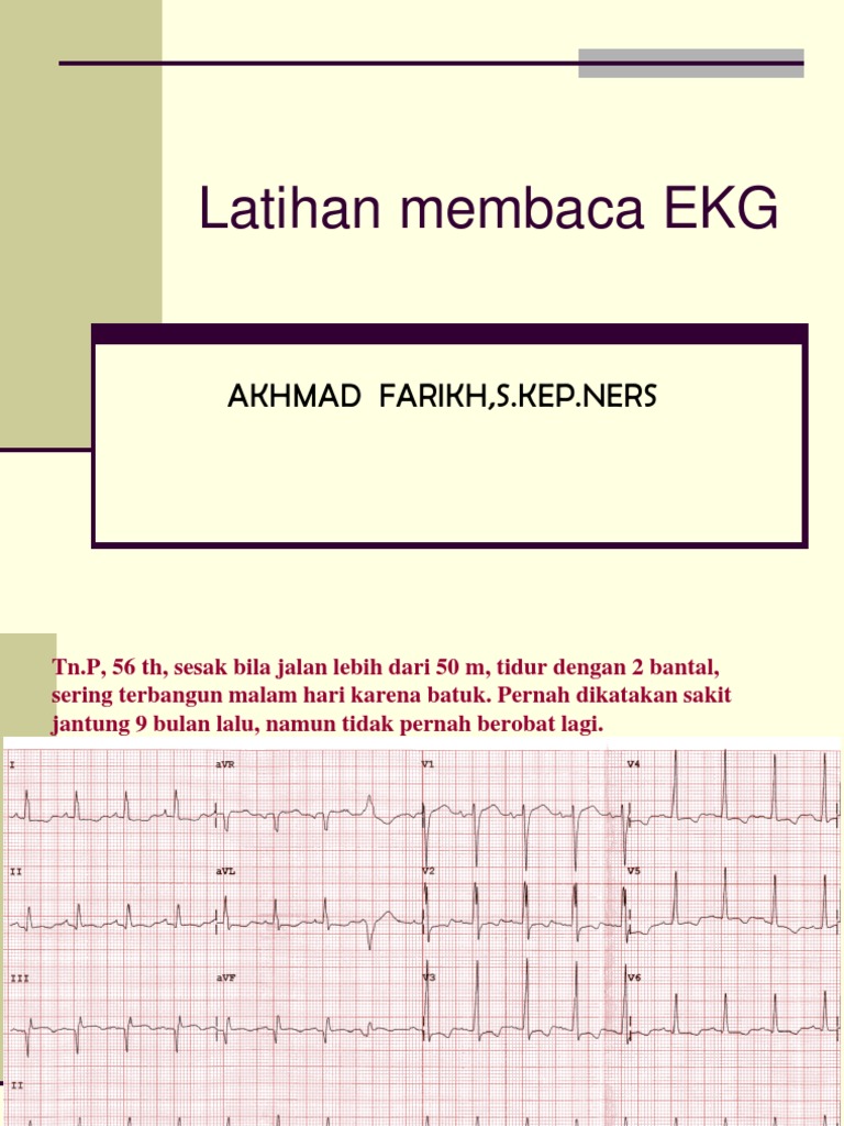 Latihan Membaca EKG