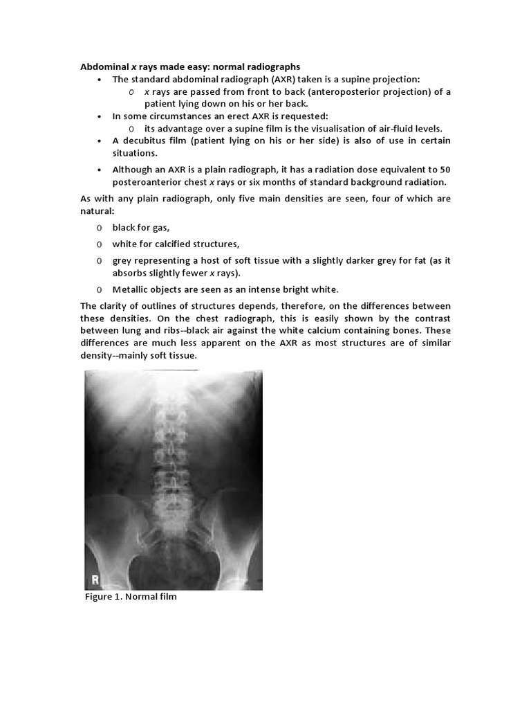 Abdominal XR | PDF | X Ray | Large Intestine