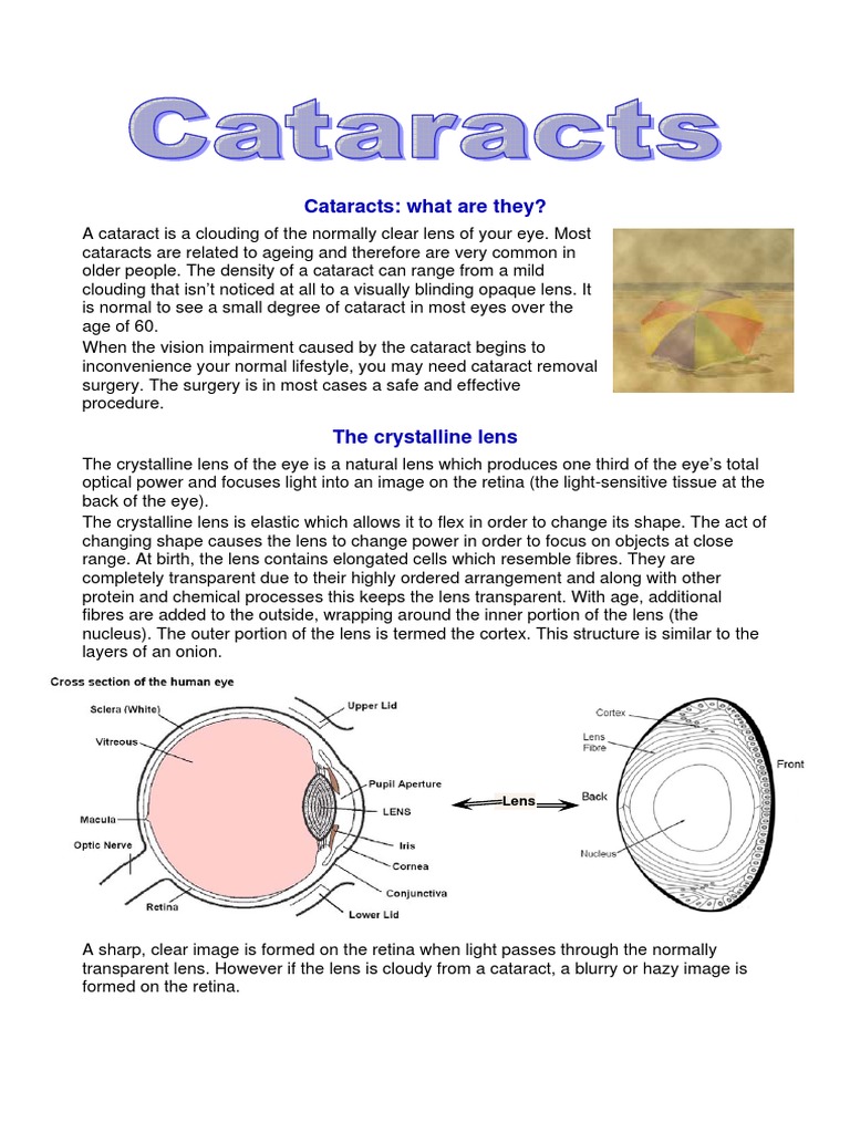 Cataracts: What Are They? | PDF | Cataract | Human Eye