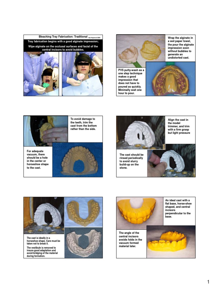 Bleaching Tray Fabrication | Download Free PDF | Dentistry Branches ...