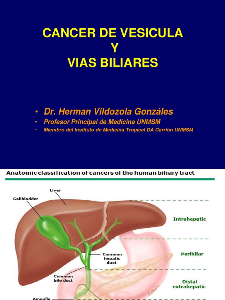 Cancer de Vesicula y Vias Biliares 2012_dr Vildozola | Cáncer | Metástasis