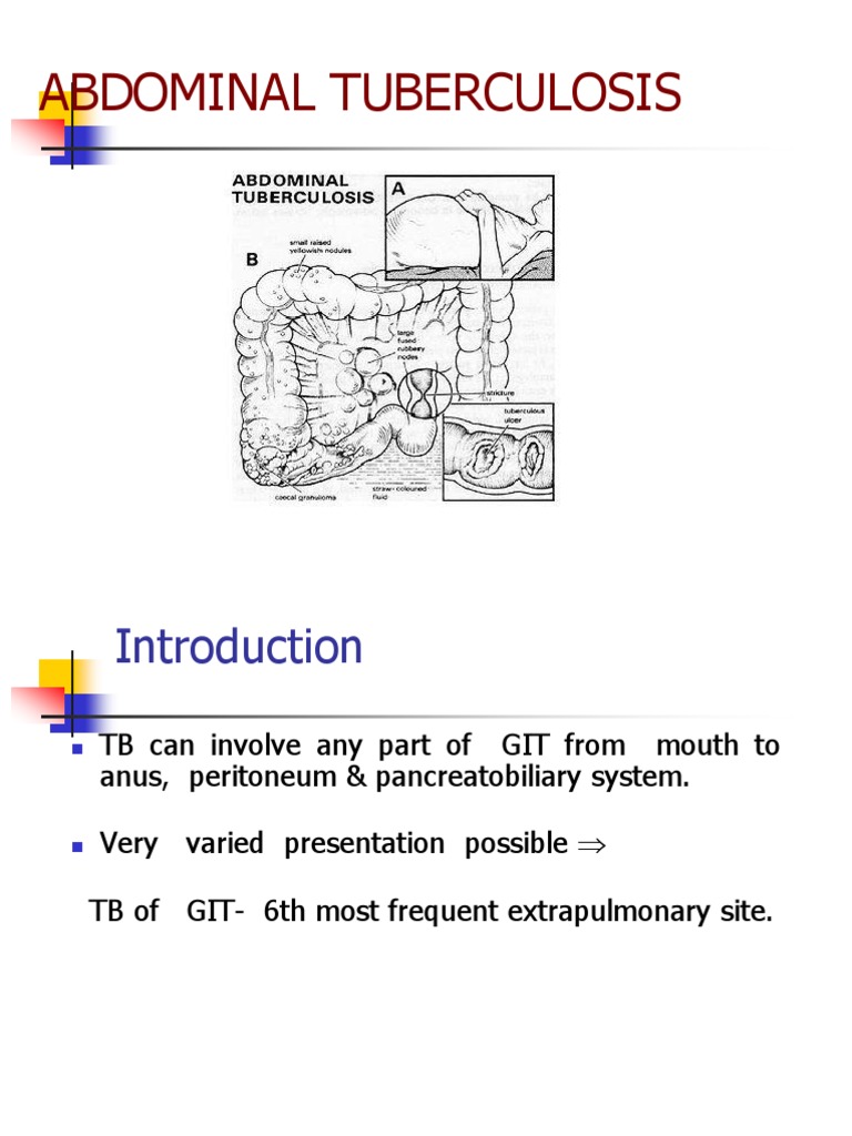 Abdominal Tuberculosis Overview and Management | PDF | Tuberculosis ...