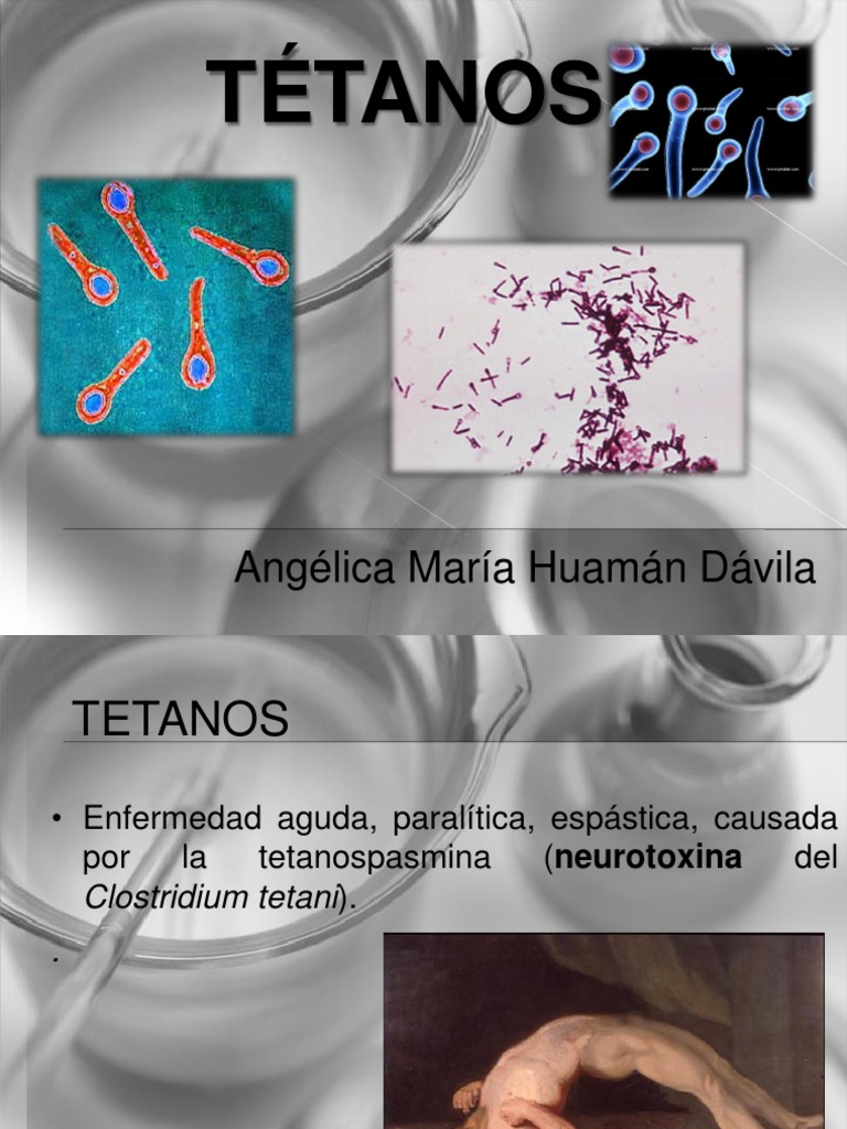 Tetanos | PDF | Enfermedades y trastornos | Medicina CLINICA