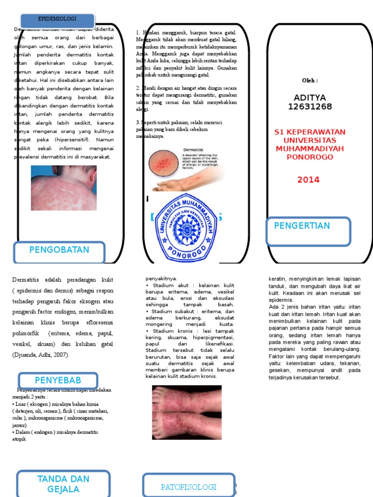 Leaflet Dermatitis Atopik | PDF