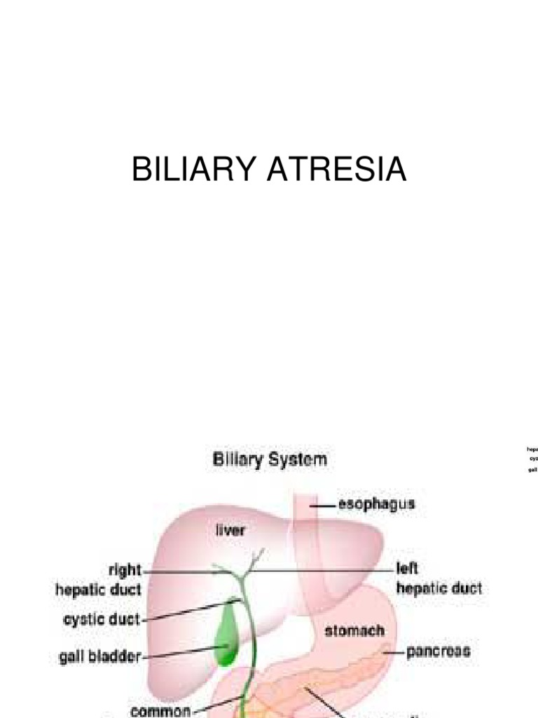 Biliary Atresia Digestive Iv Pdf Liver Bile
