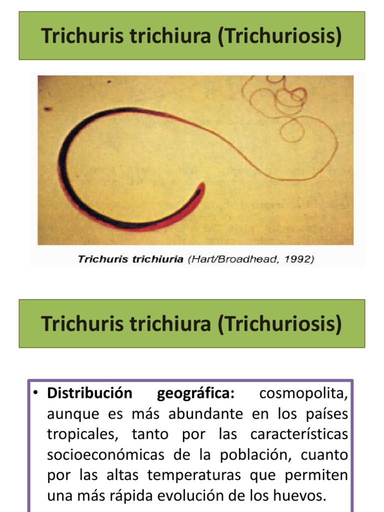 Trichuris Trichiura (Trichuriosis) | Especialidades Medicas ...