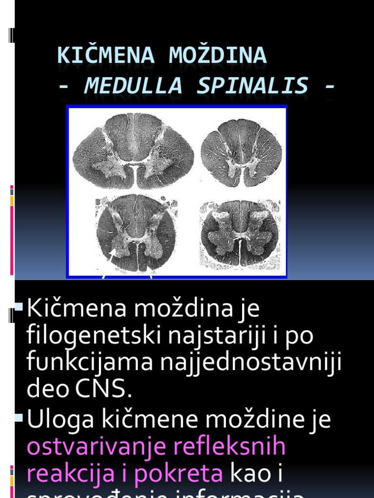 Kicmena Mozdina | PDF