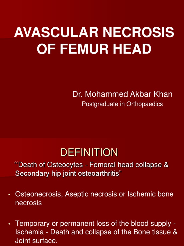 Avascular Necrosis of Femoral Head | PDF | Clinical Medicine | Medical ...