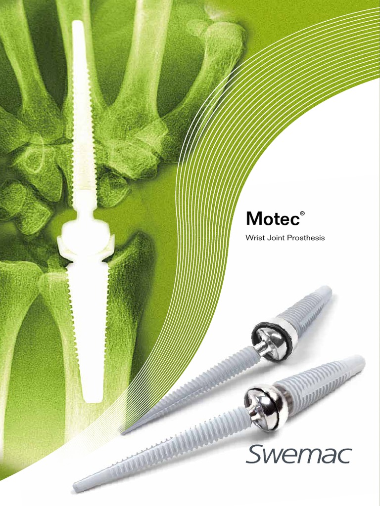 Motec Wrist Joint Prosthesis Brochure | Dental Implant | Arthritis