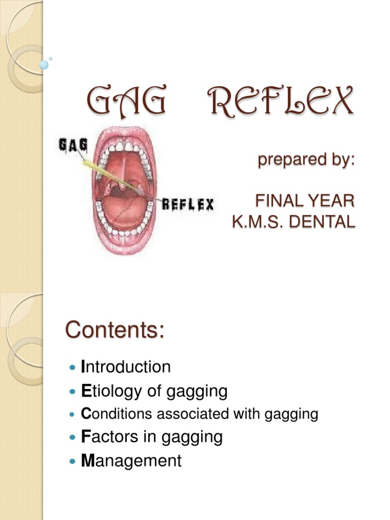 Gag Reflex: Prepared By: Final Year K.M.S. Dental | PDF | Dentures ...