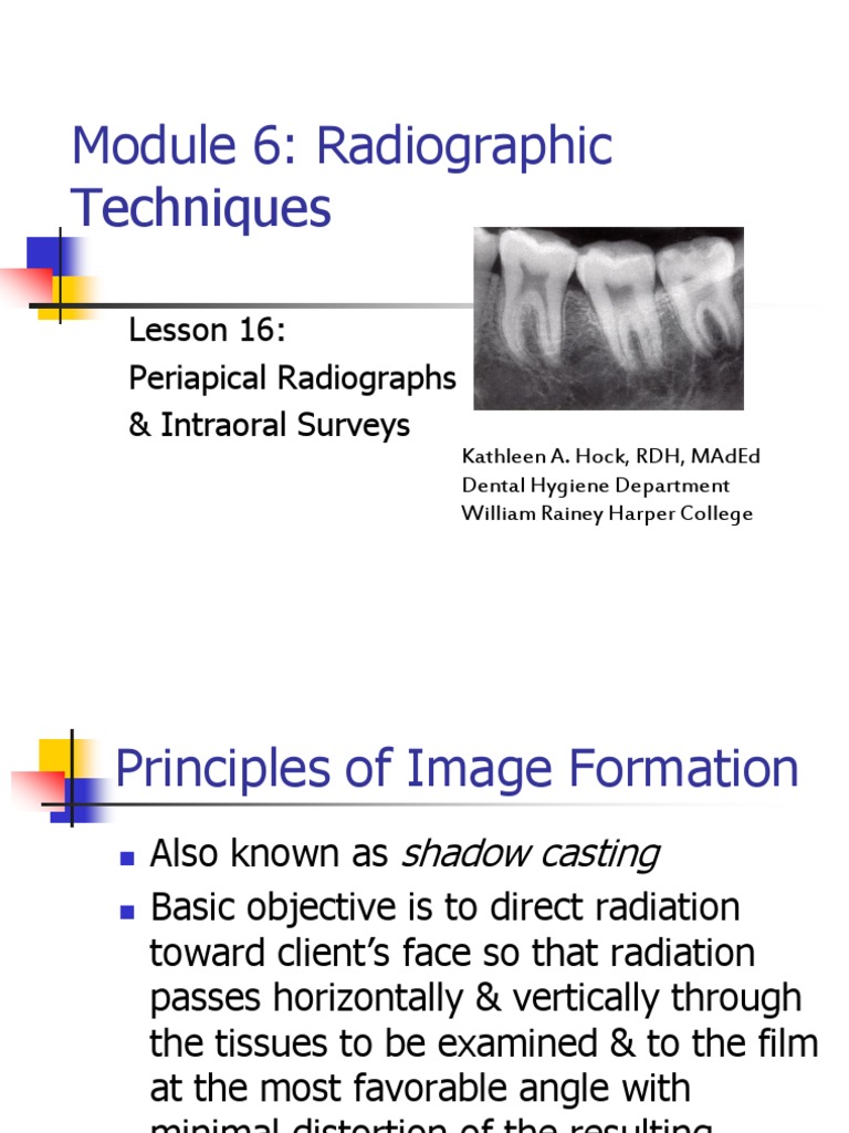 Module 6: Radiographic Techniques: Lesson 16: Periapical Radiographs ...