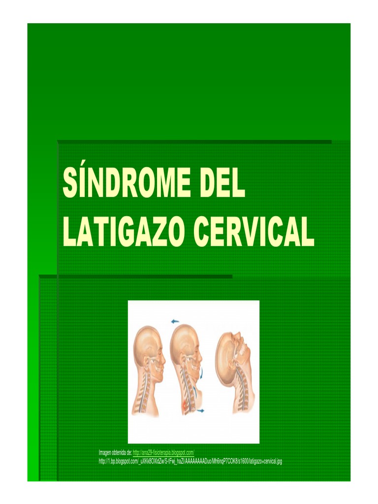 Latigazo Cervical Power Point | PDF | Parestesia | Medicina CLINICA