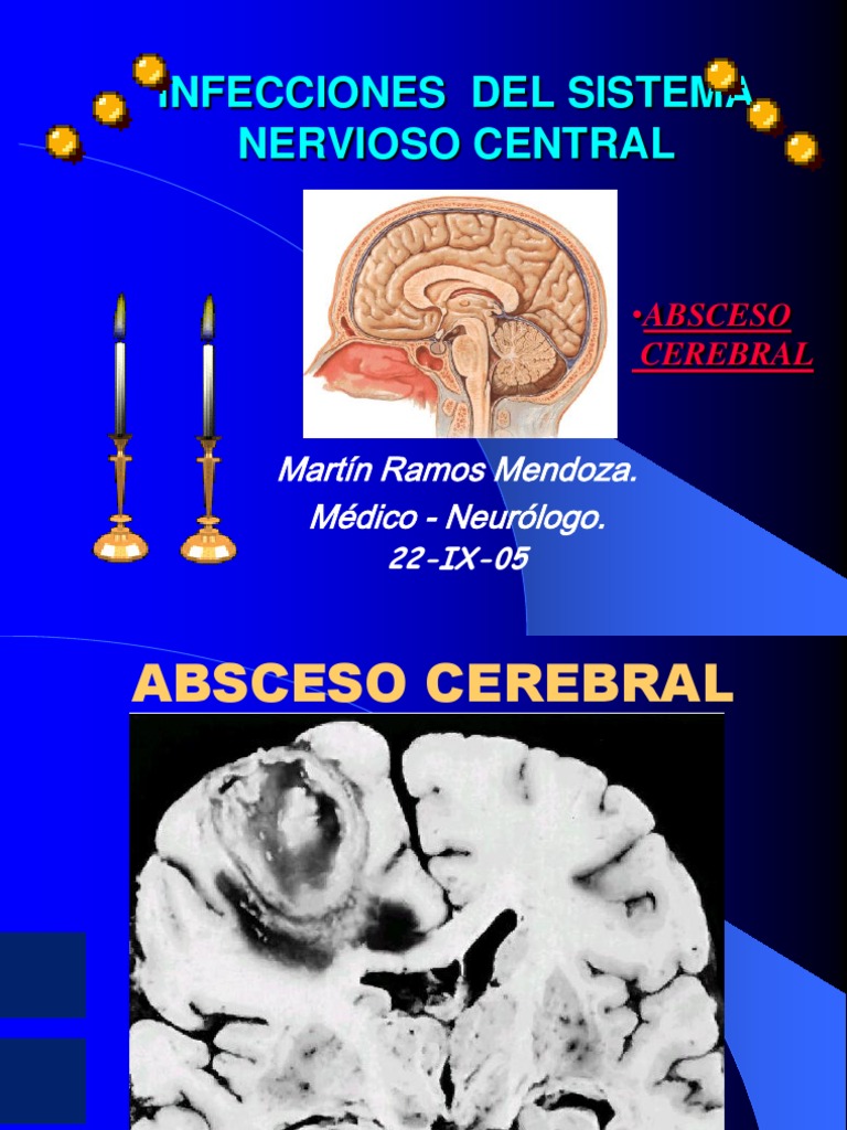 Absceso Cerebral | PDF | Microbiología | Medicina