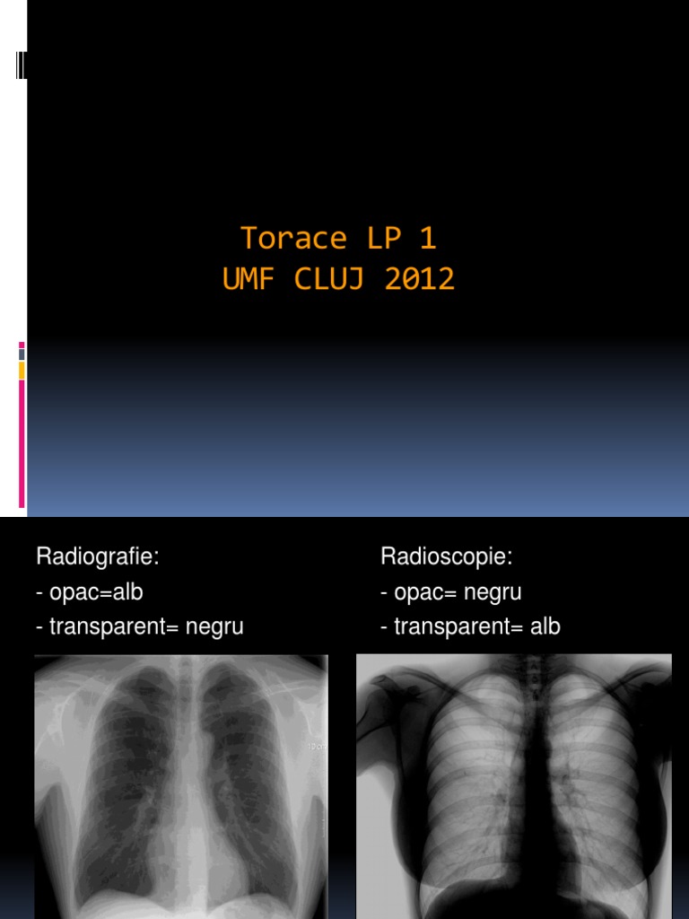 Torace LP 1 (Anatomie Radiologica) | PDF