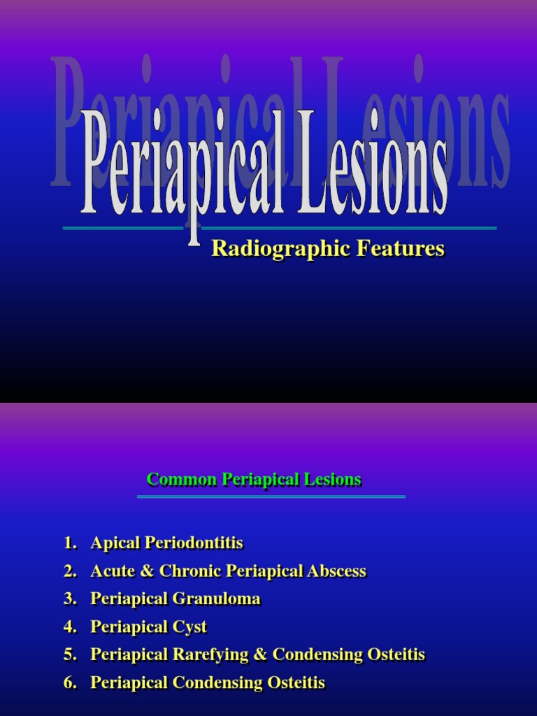 Periapical Lesions | Dentistry | Dentistry Branches