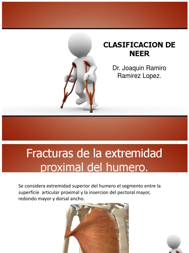Clasificacion de Neer Unt | PDF