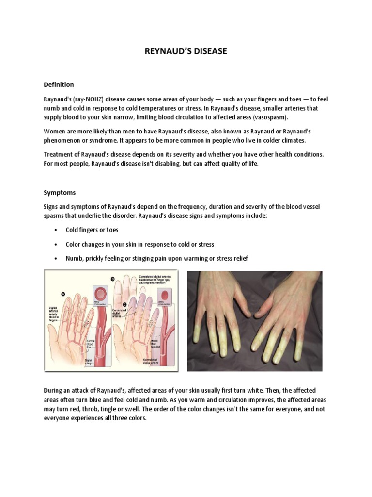 Understanding Raynaud's Disease: Causes, Symptoms, Diagnosis and ...