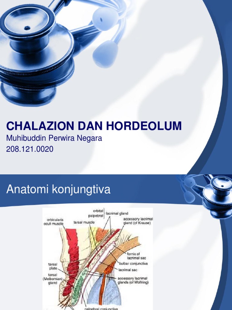 Chalazion Dan Hordeolum | PDF