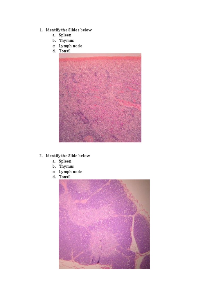 Histology Quiz 3 | Lymphatic System | Circulatory System