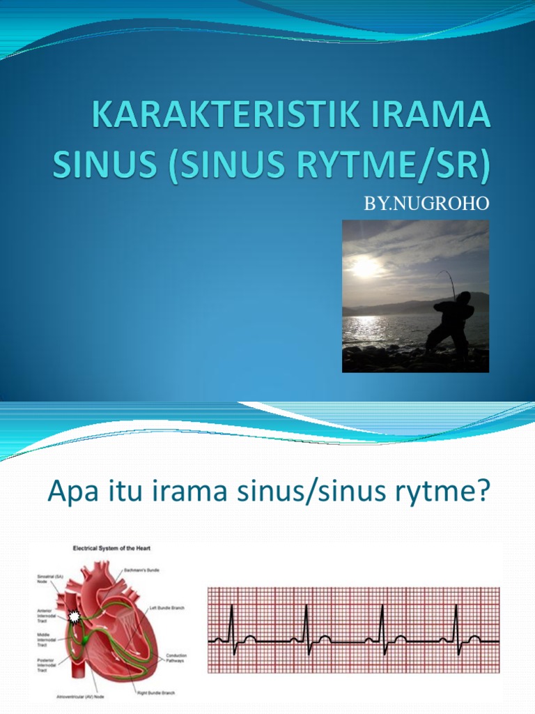 Karakteristik Irama Sinus (Sinus Rytme | PDF