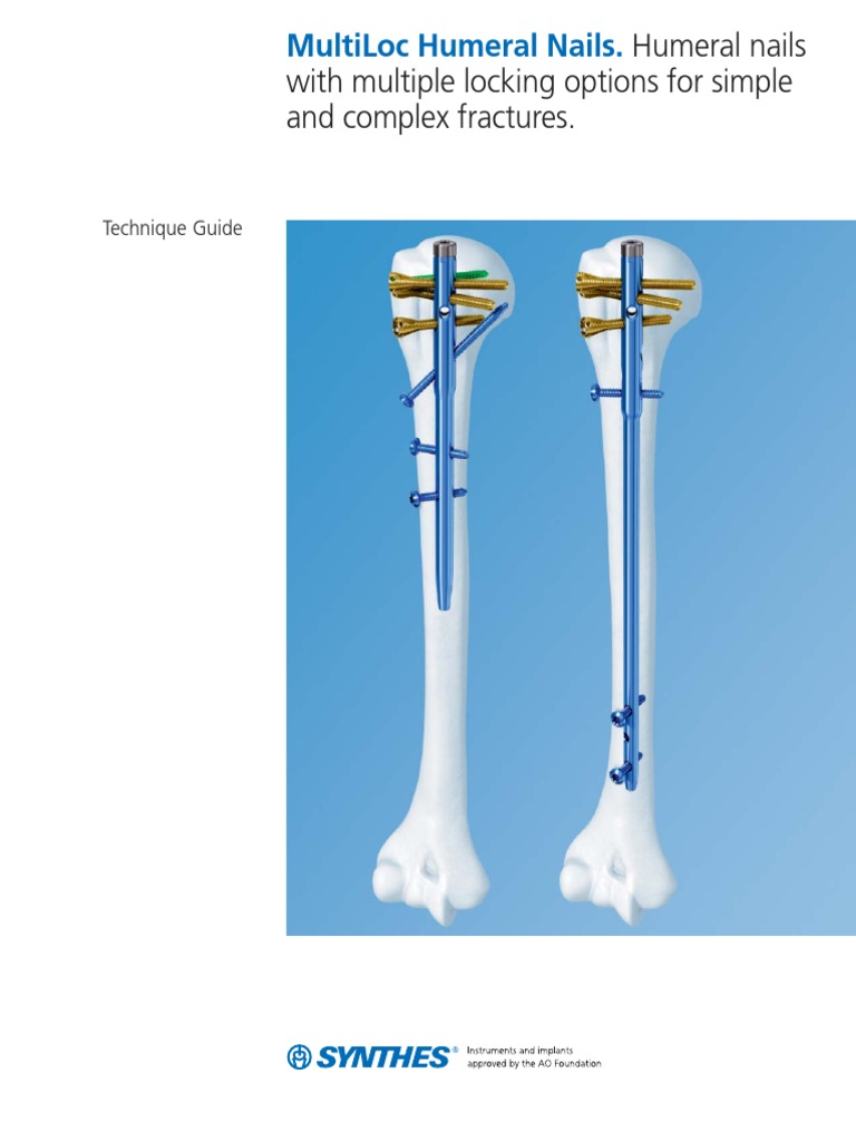 Humeral Nail Tech Guide | PDF | Screw | Drill
