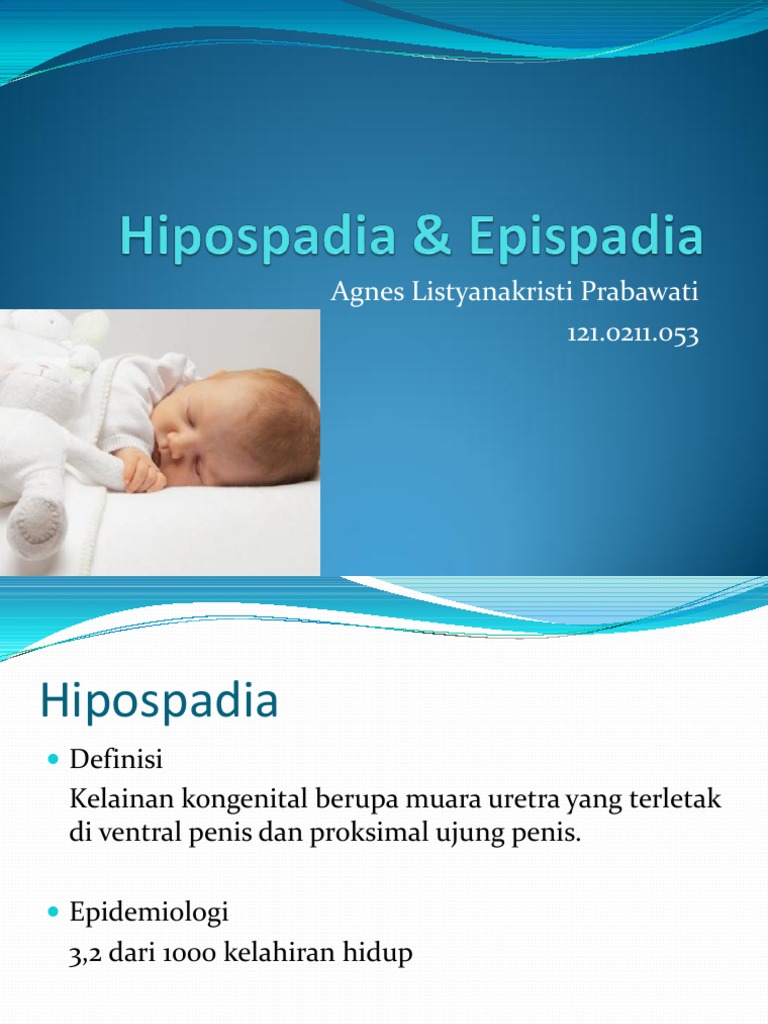 Hipospadia & Epispadia | PDF