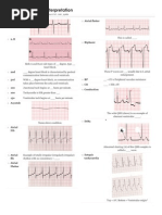 Basic Arrhythmia Rules | PDF | Electrocardiography | Physiology