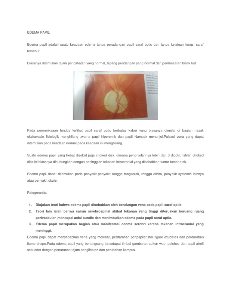 Edema Papil | PDF